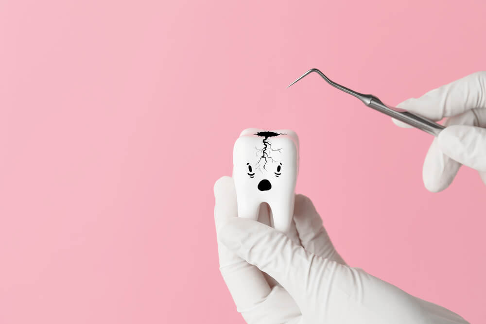 Zubni karijes || LUMIDENT STUDIO